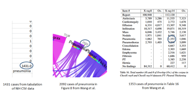 CheXNet: an in-depth review – Lauren Oakden-Rayner