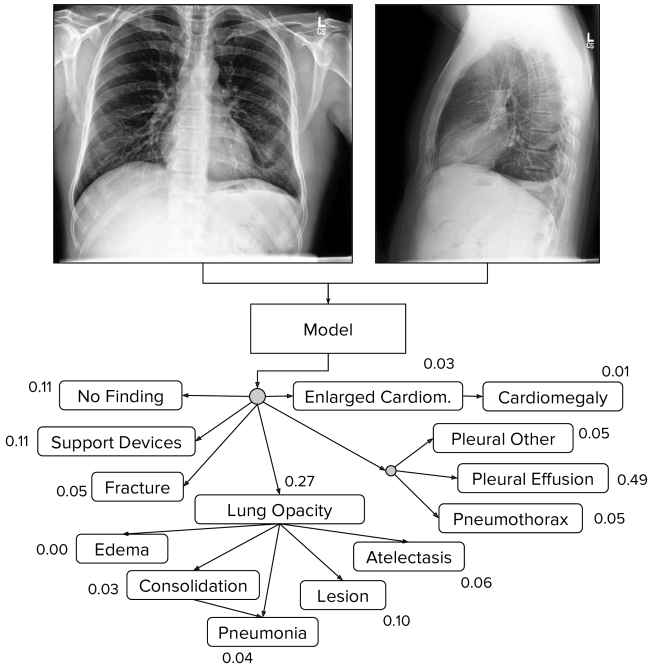 Half a million x-rays! First impressions of the Stanford and MIT chest ...